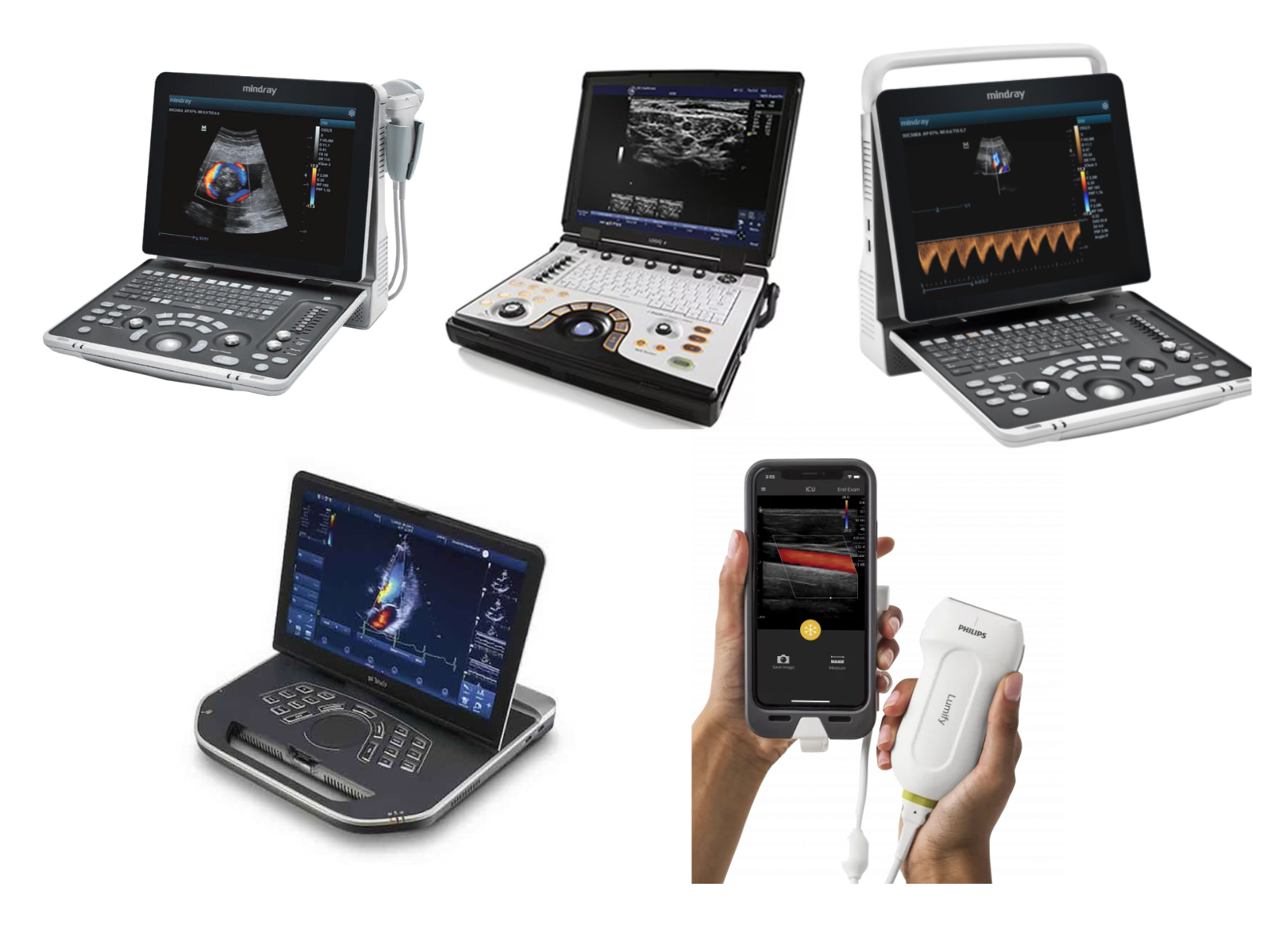 Les 7 critères pour choisir un échographe portable