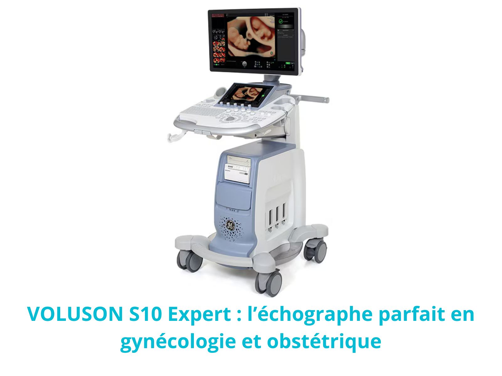 VOLUSON S10 Expert : L'échographe parfait en gynécologie